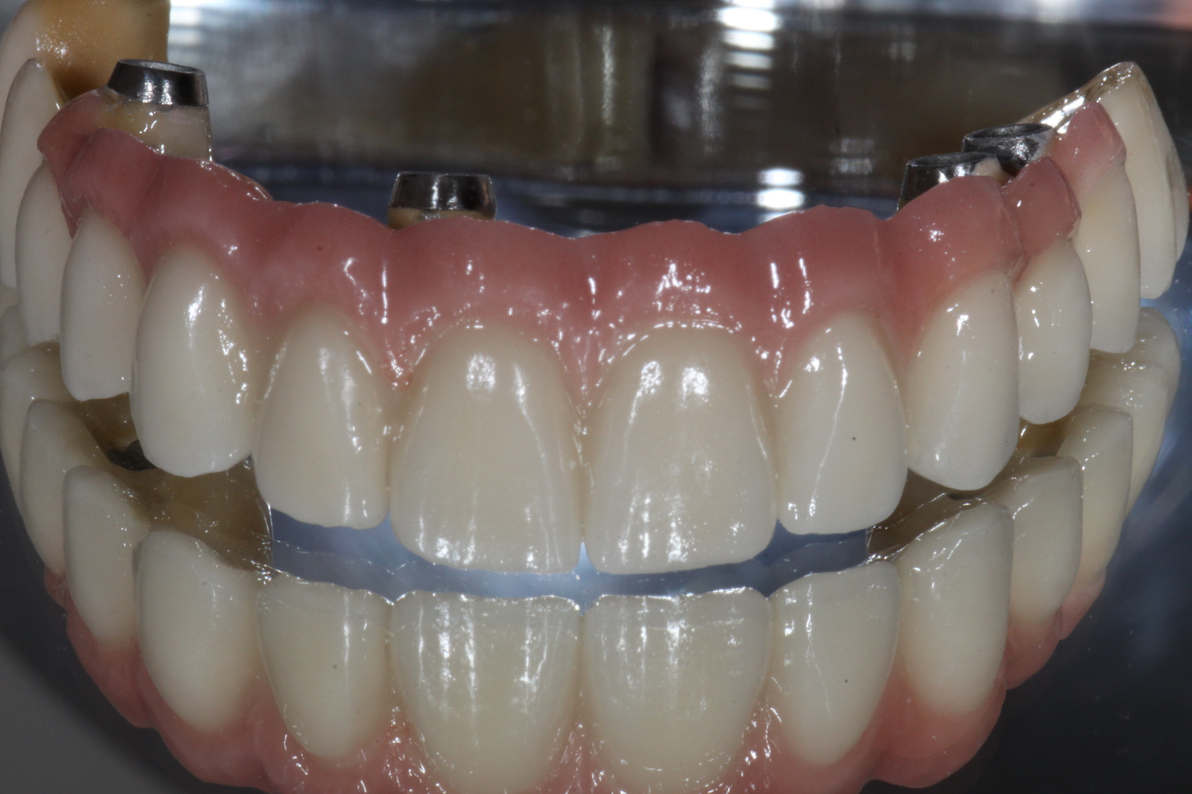 WS LAB | Estética Dentária